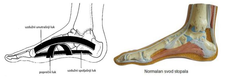 Deformiteti stopala – Uzroci, simptomi i tretmani